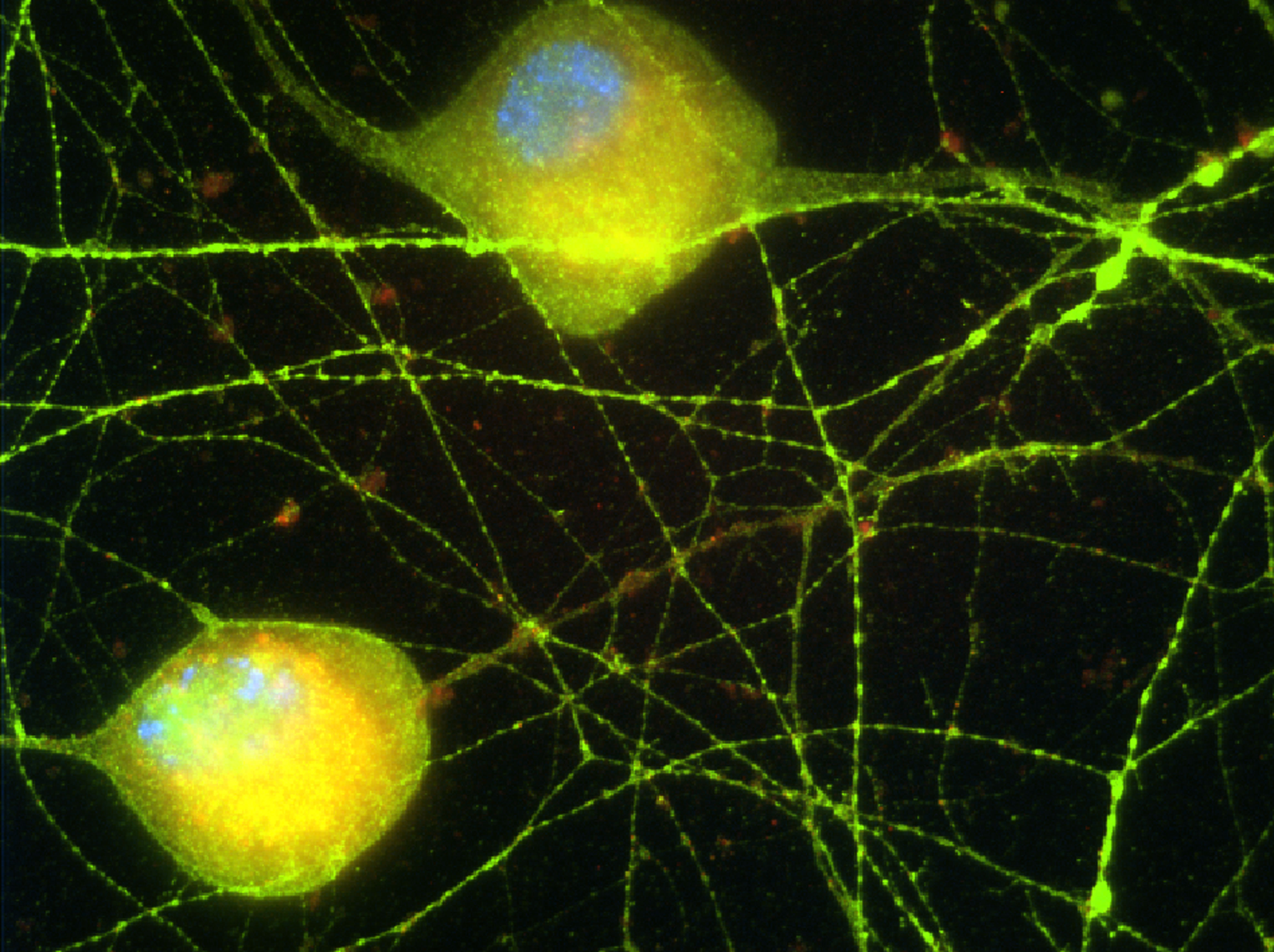 To spread, nervous system viruses sabotage cell, hijack transportation