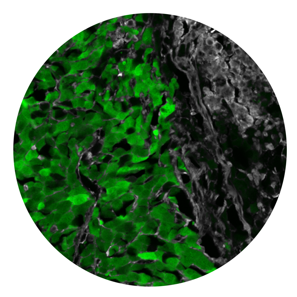 Princeton's world-class microscopes are making a giant impact in the ...