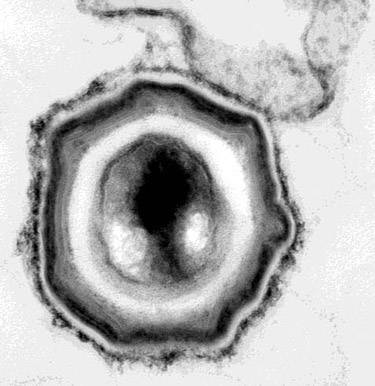 Biologists discover extra layer of protection for bacterial spores