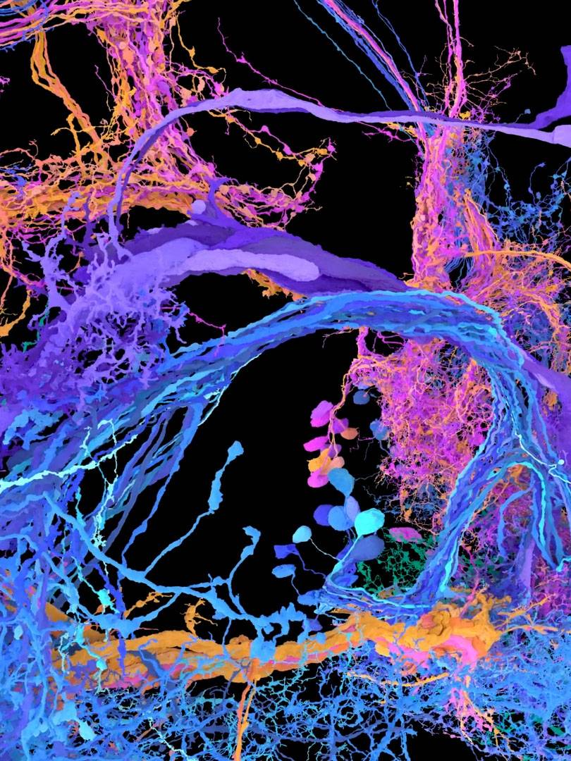 Mapping an entire (fly) brain: A step toward understanding diseases of ...