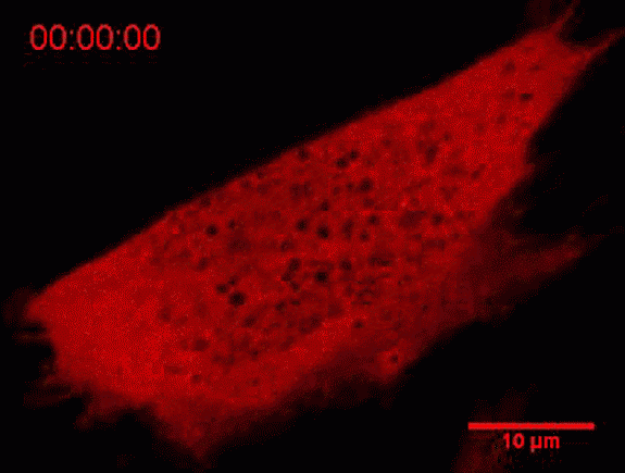 New tool shines a light on protein condensation in living cells